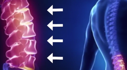 Lumbar Disc - Healthier Illinois